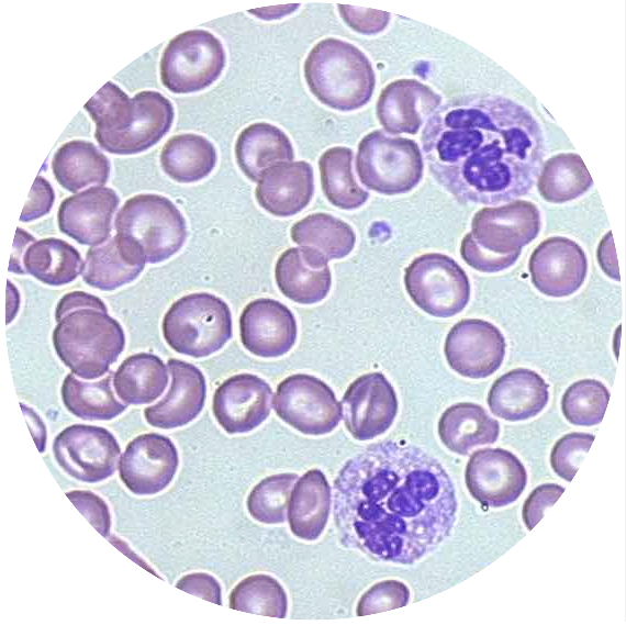 RBC Morphology Case Simulator